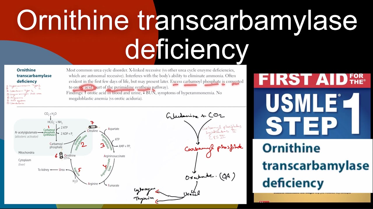 Ornithine transcarbamylase deficiency - M/C urea cycle defect in Hindi ...