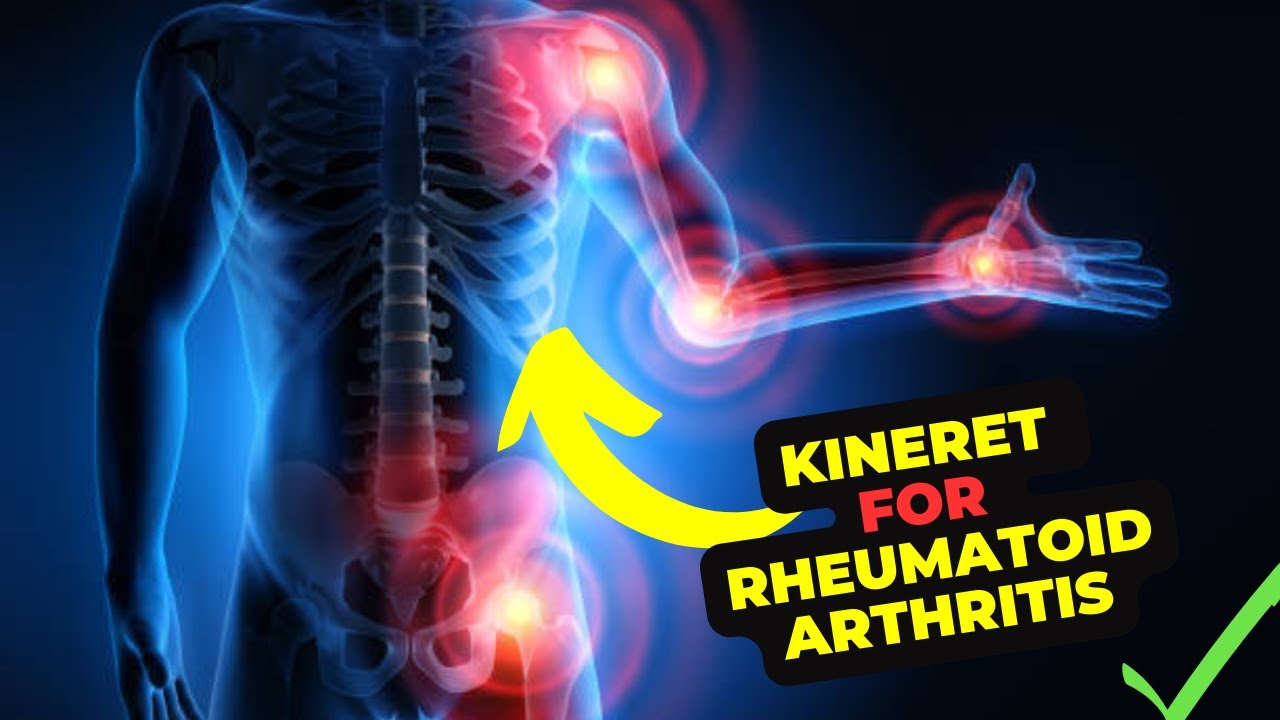 Kineret Injections: How They Work, Benefits, and Side Effects Explained ...