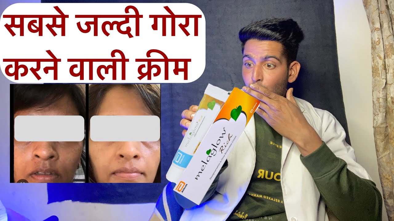 गोरा करने वाली क्रीम | Melaglow rich cream | Melaglow rich cream review ...
