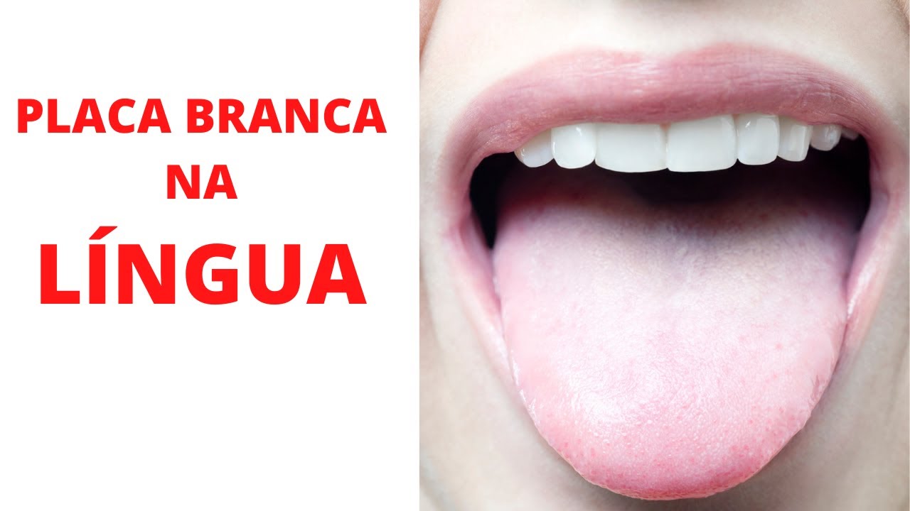 Saburra Branca Na Lingua A Importância De Escovar A Língua Sérgio