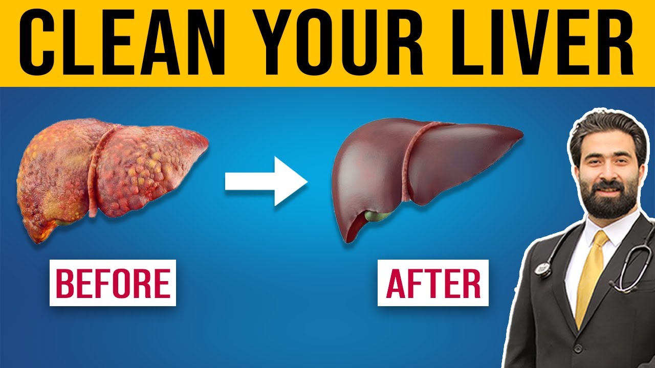Top 10 Foods to Clean Out Your Liver (Reverse Fatty Liver) - YouTube