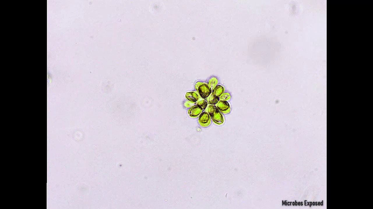 Green algae Coelastrum sp. - YouTube