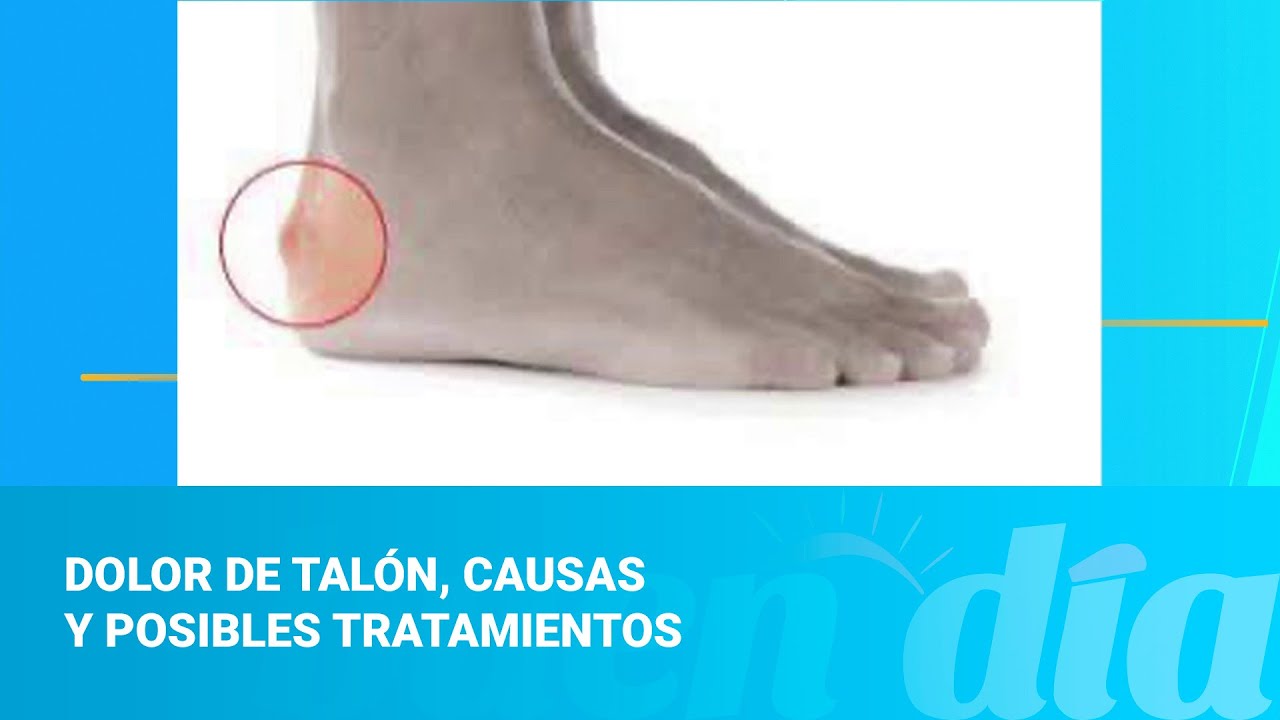 Dolor de talón, causas y posibles tratamientos - YouTube