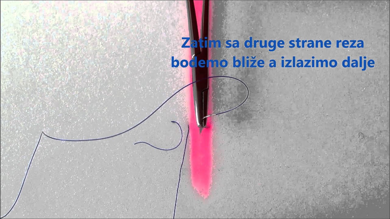 Lembertov šav - Lembert suture - YouTube