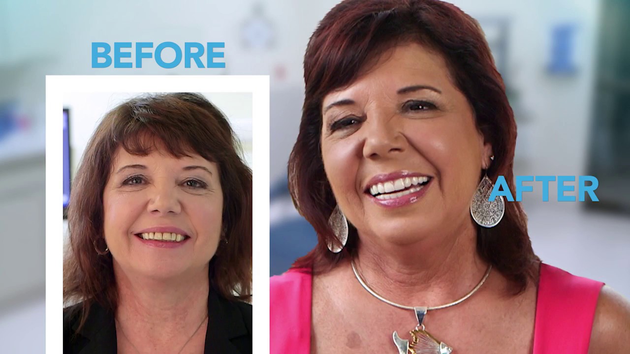 Dr. Lawrence Musser, New Teeth Now WebChat 2016 - YouTube