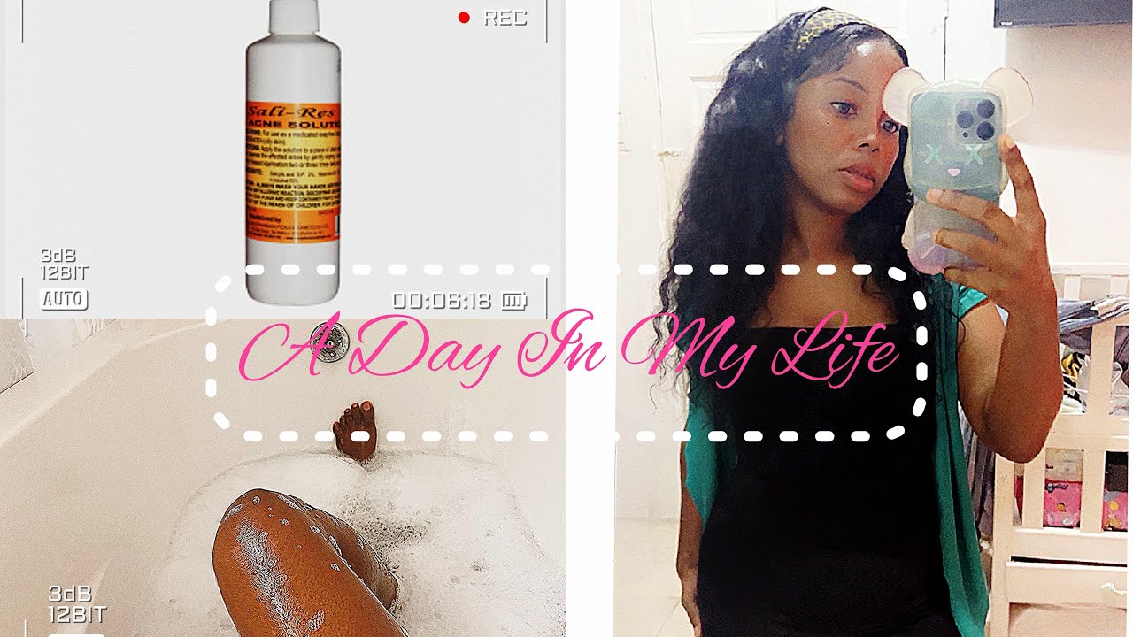 A DAY IN MY LIFE // Sali-Res Acne Solution // Self Care 💆‍♀️ - YouTube