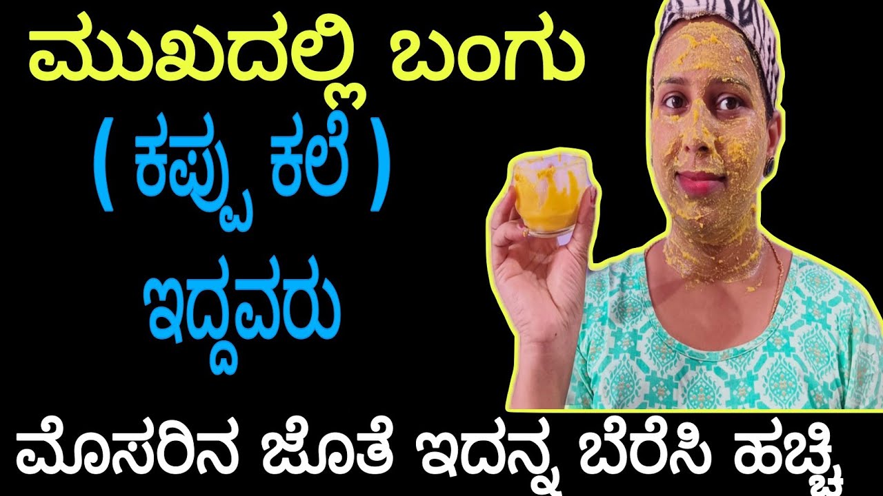Home Remedies for Pigmentation | Bangu ge mane maddu | ಕಪ್ಪು ಕಲೆ ಬಂಗು ...