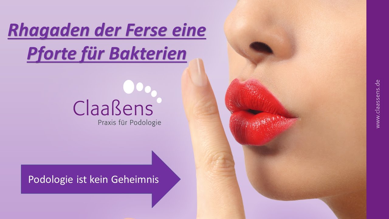 Rhagaden Quelle von Bakterien - YouTube