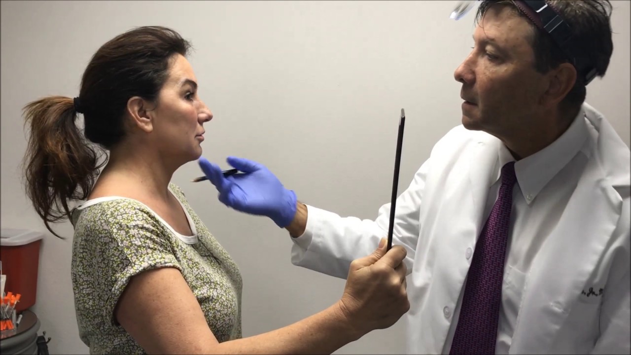 Measuring and marking for facial rejuvenation. - YouTube