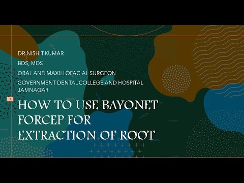 HOW TO USE BAYONET FORCEPS FOR MAXILLARY MOLAR ROOT BY NISHIT KUMAR ...