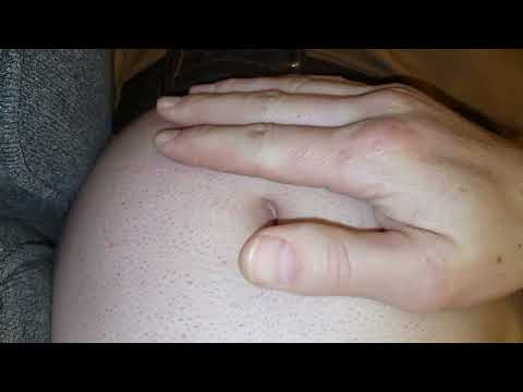 Coke and Mentos Belly Sounds - Part 2