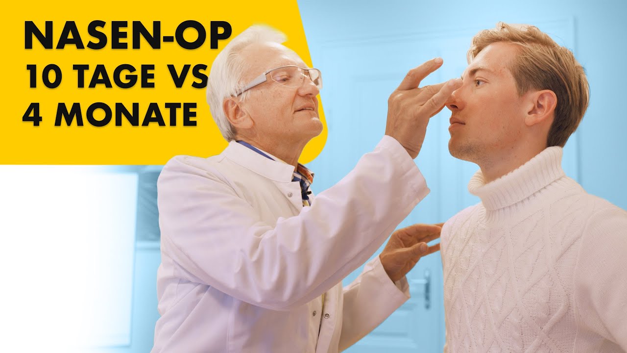 Nasenkorrektur Heilungsverlauf - 10 Tage VS 4 Monate nach OP | Dr ...