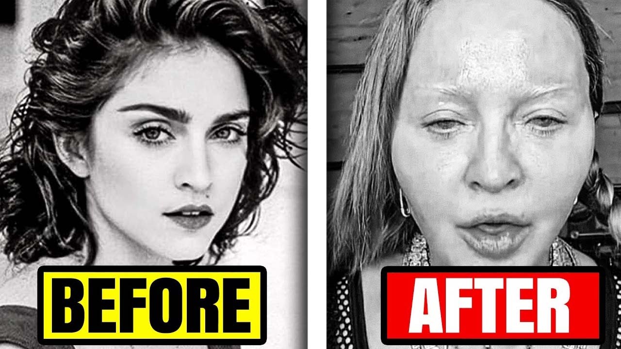 Celebrities Who Aged TERRIBLY – You Won’t Believe #7 - YouTube