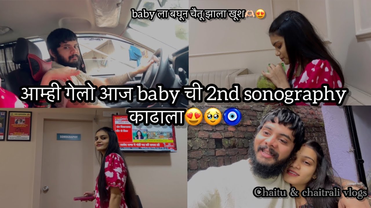 Vlog510 | आम्ही गेलो आज baby ची 2nd sonography काढाला😍🥹🧿 | chaitu ...