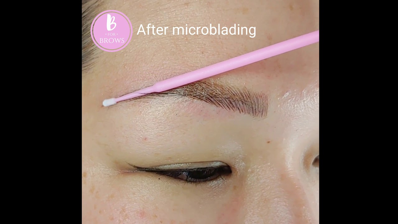 90s Over Plucked Eyebrows Microblading Transformation. Microblading ...