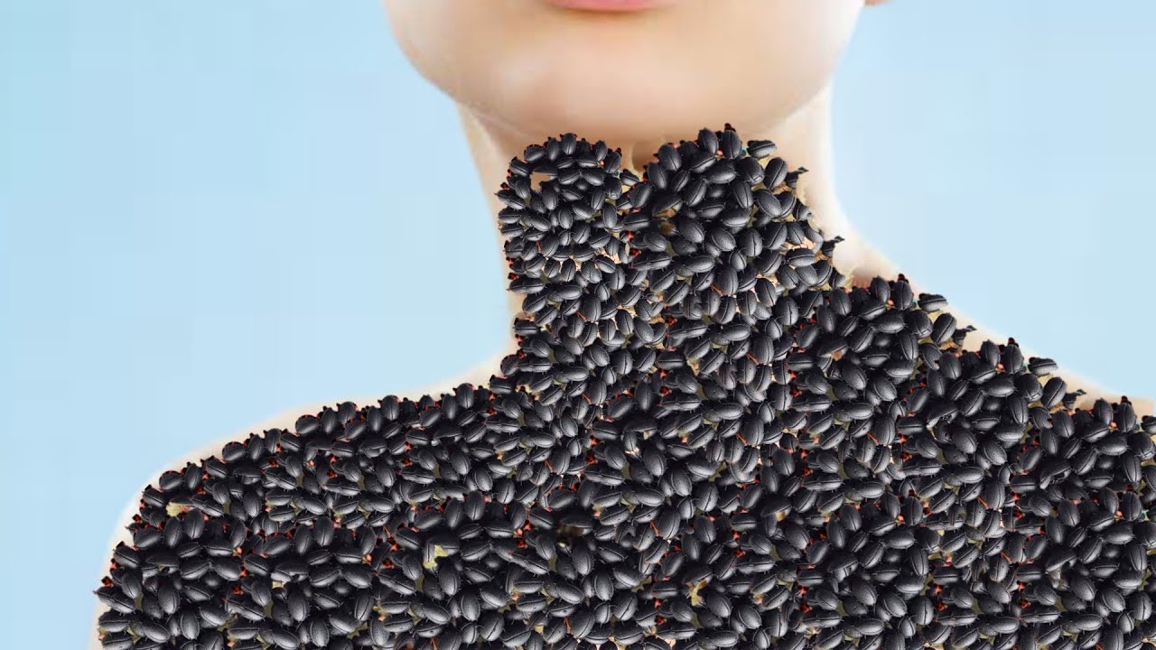 ASMR Satisfy In sleep 😴 Elbow, tran face Treatment Animation | Infected ...