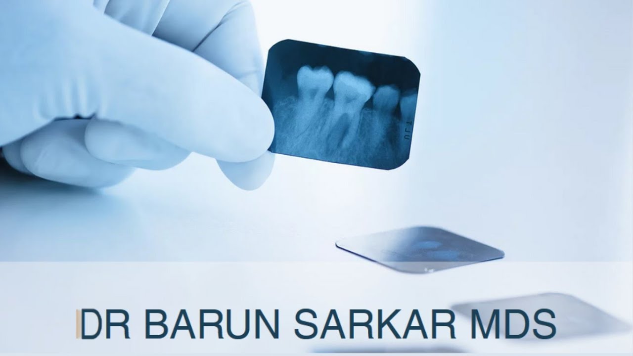 modified stillman brushing technique - YouTube