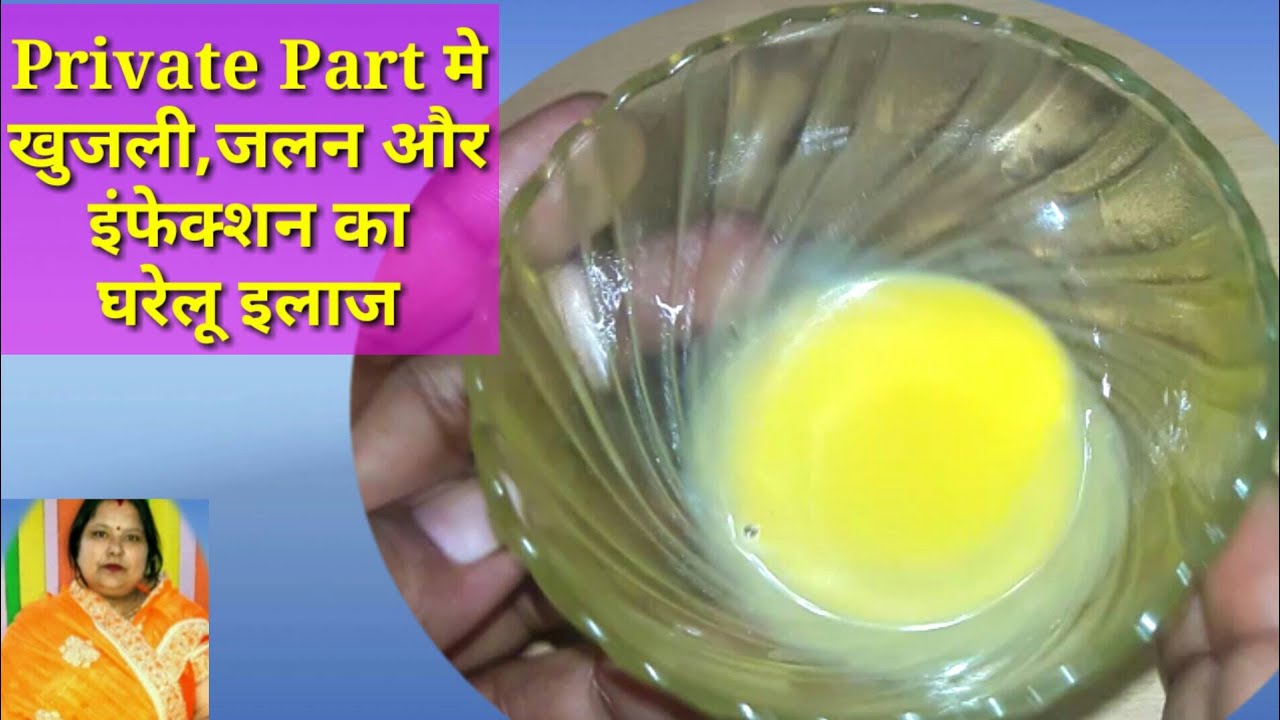 1 मिनट मे प्राइवेट पार्ट की खुजली,जलन,सूजन खत्म करें इस रामबाण नुस्खे ...