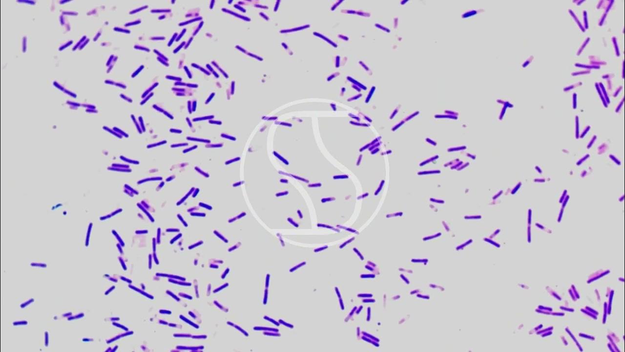 Clostridium Difficile Under The Microscope With Gram Stain Youtube