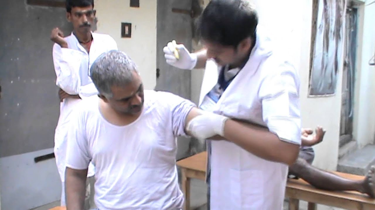 Dr. Leech can benefit you in many ways @ Nadipathy - Kakinada - YouTube