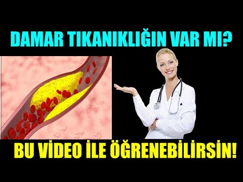 DAMAR TIKANIKLIĞIN OLUP OLMADIĞINI ANLAMAK İSTİYORSAN BU VİDEOYU İZLE!