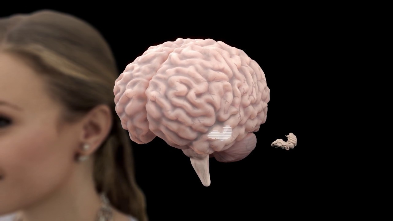 Animation - the scale of the brain in 90 seconds - YouTube