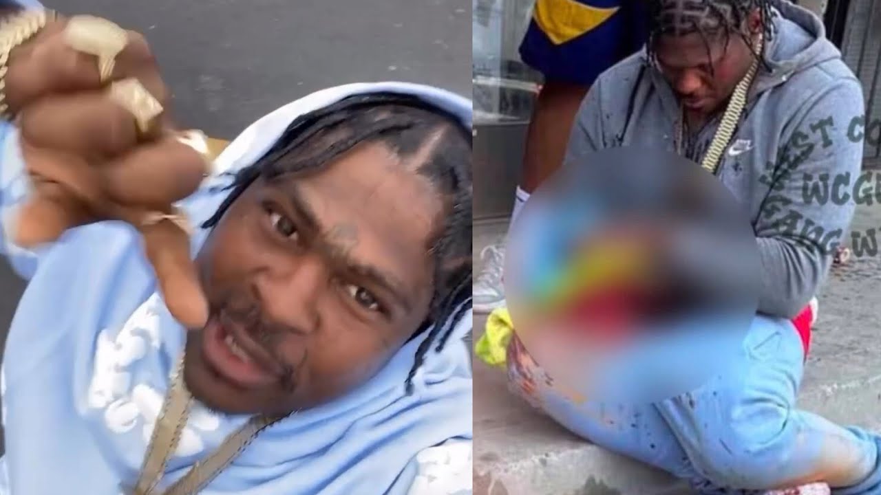 4Xtra Responds After Blowing Off His Hand With Fireworks & Sends A ...