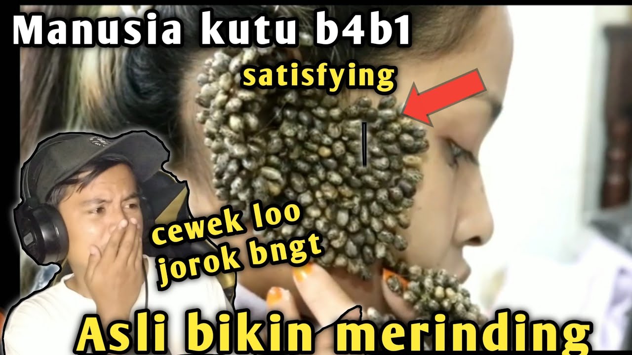ASLI MENJIJIKKAN BANYAK KUTU B4B1 DI MUKA WANITA INI | asli bikin ...