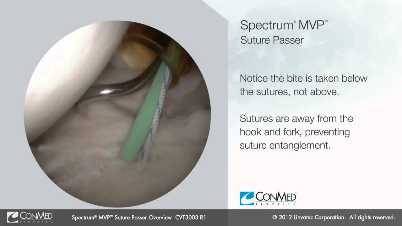 ConMed Linvatec Spectrum® MVP™ Suture Passer Overview - YouTube