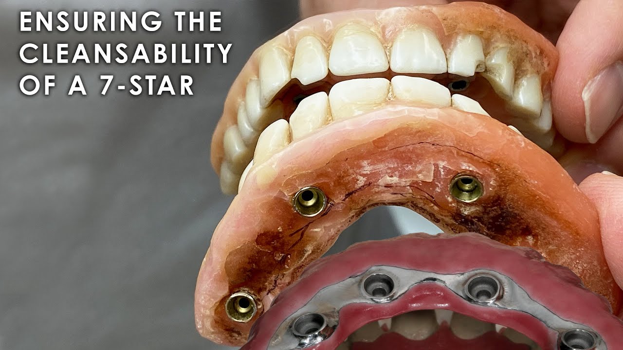 Ensuring the Cleansability of a 7-Star - YouTube