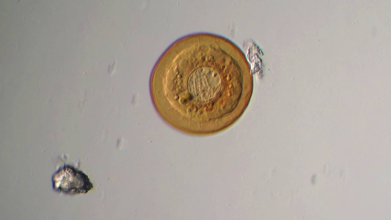 Microscopic World - Protozoa - Amoeba - Arcella sp. - YouTube