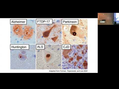 CTSI Distinguished Speaker Series I Aaron Gitler - YouTube