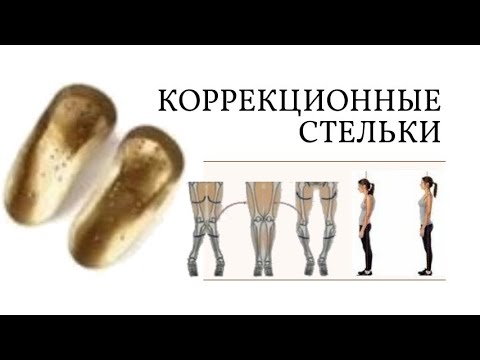 Коррекционные стельки Гучженцзи. Стельки ортопедические как выбрать ...