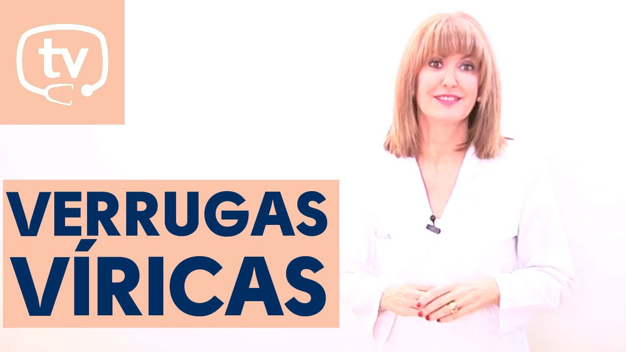 ¿Qué son y cómo se tratan las verrugas víricas? - YouTube