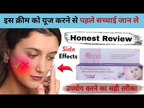 Elosone ht skin cream||Elosone ht skin cream kaise use kare||Elosone ht skin cream side effects