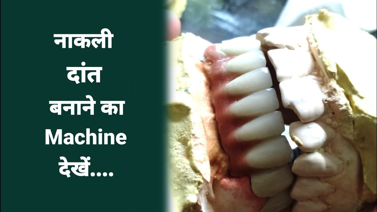 Nakli Dant Banane Ka Machine!! Dant kese banta hai!! Dental lab works ...