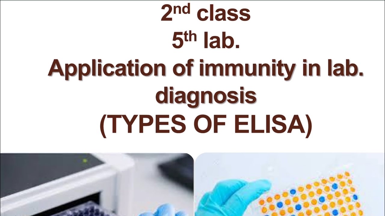Microbiology practical (types of ELIZA /lab5) - YouTube