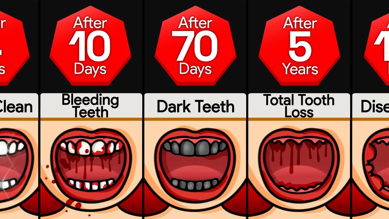 Timeline: What If You Never Brush Your Teeth - YouTube