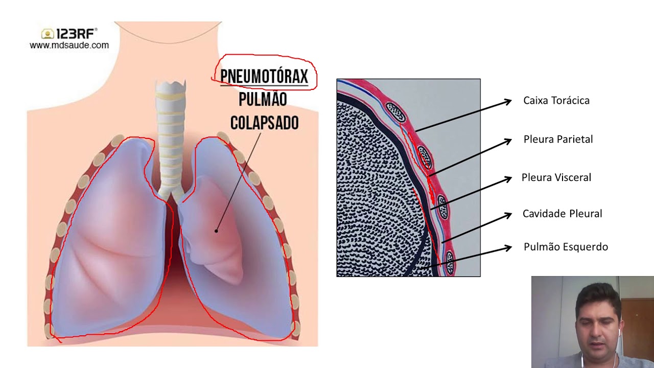 Via aérea inferior - YouTube