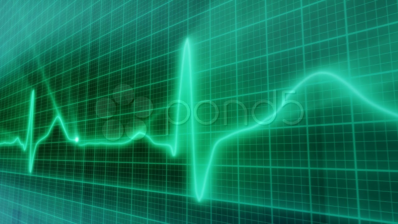 Loopable Background Ekg Electrocardiogram Pulse Real Waveform. Stock ...