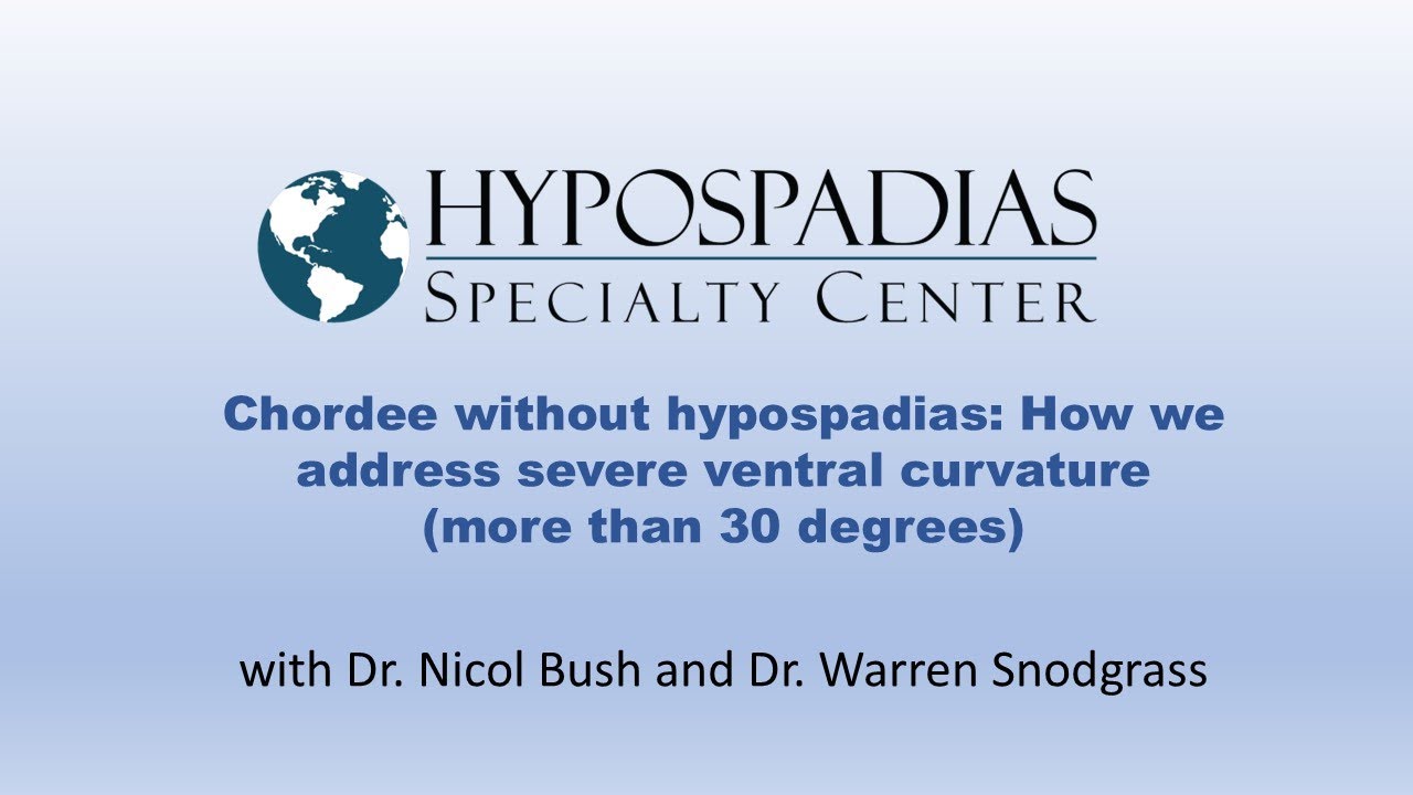 Chordee without hypospadias: How we address severe ventral curvature ...