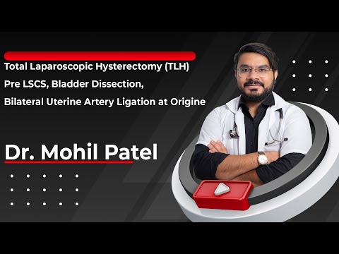 Total Laparoscopic Hysterectomy (TLH) Pre LSCS Uterine Artery Ligation ...
