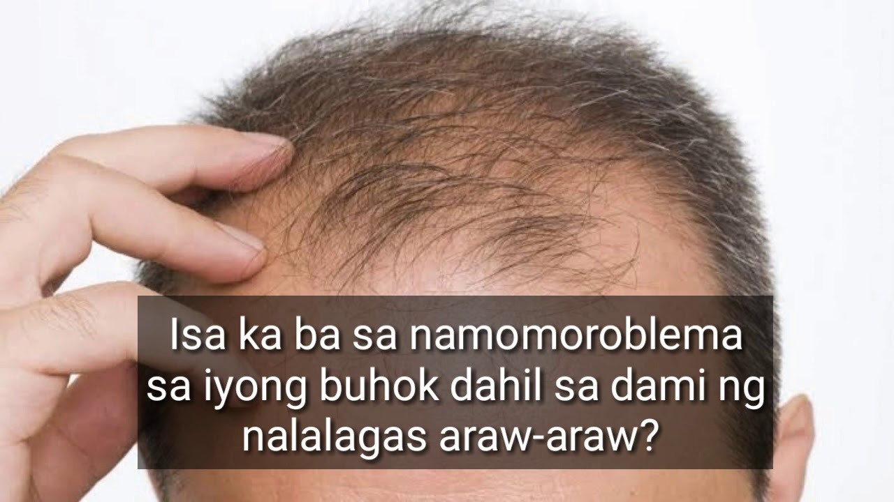 SOLUSYON SA PANOT NA BUHOK - YouTube