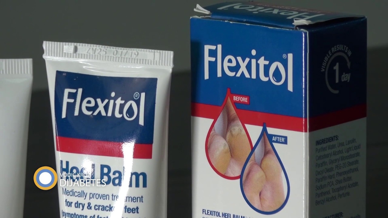 205. emisija prilog Flexitol kreme - YouTube