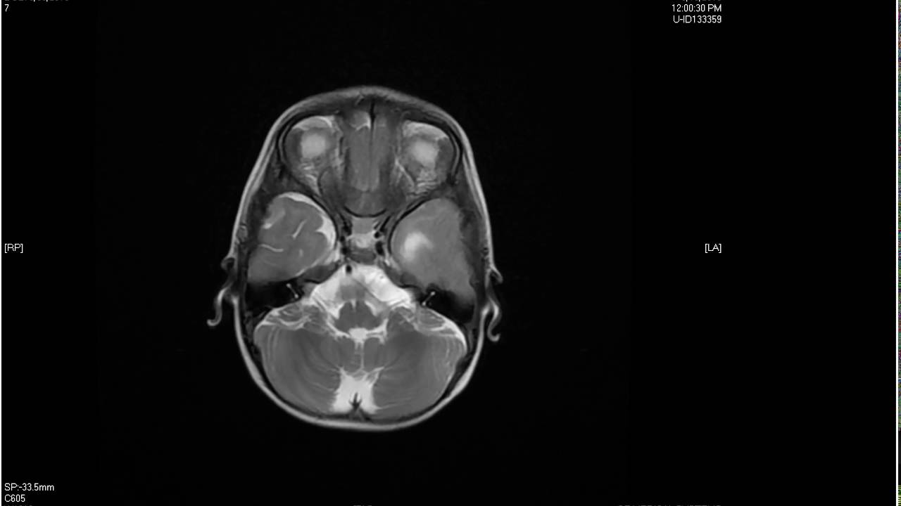 MR AX T2 FSE - YouTube