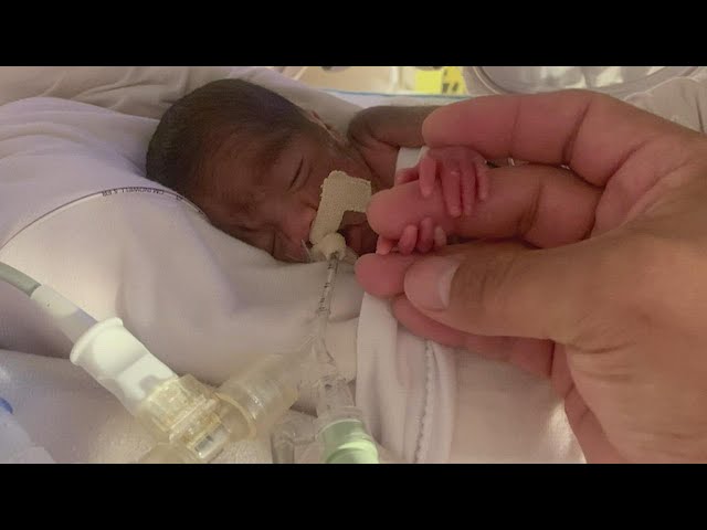 Images Of 18 Week Old Fetus 18 Weeks Pregnant: Symptoms And Baby