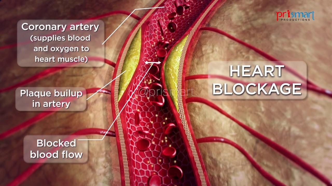 Bloodline | Hospital Marketing Videos | 3D Medical Videos | Human ...