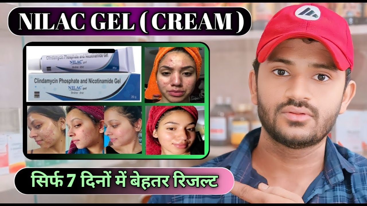 Nilac gel uses in hindi how to use nilac gel - YouTube
