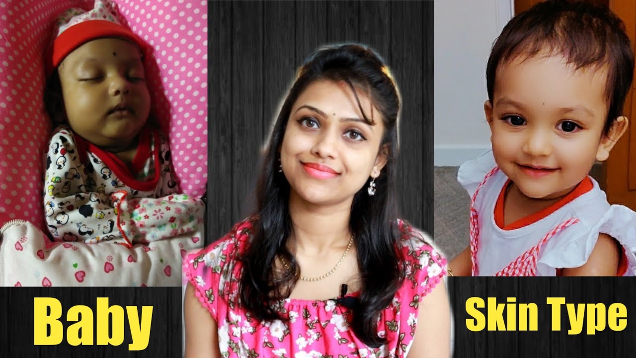 How To Know Baby Skin Type || Baby Skin Fairness Tips || শিশুর ত্বকের ...