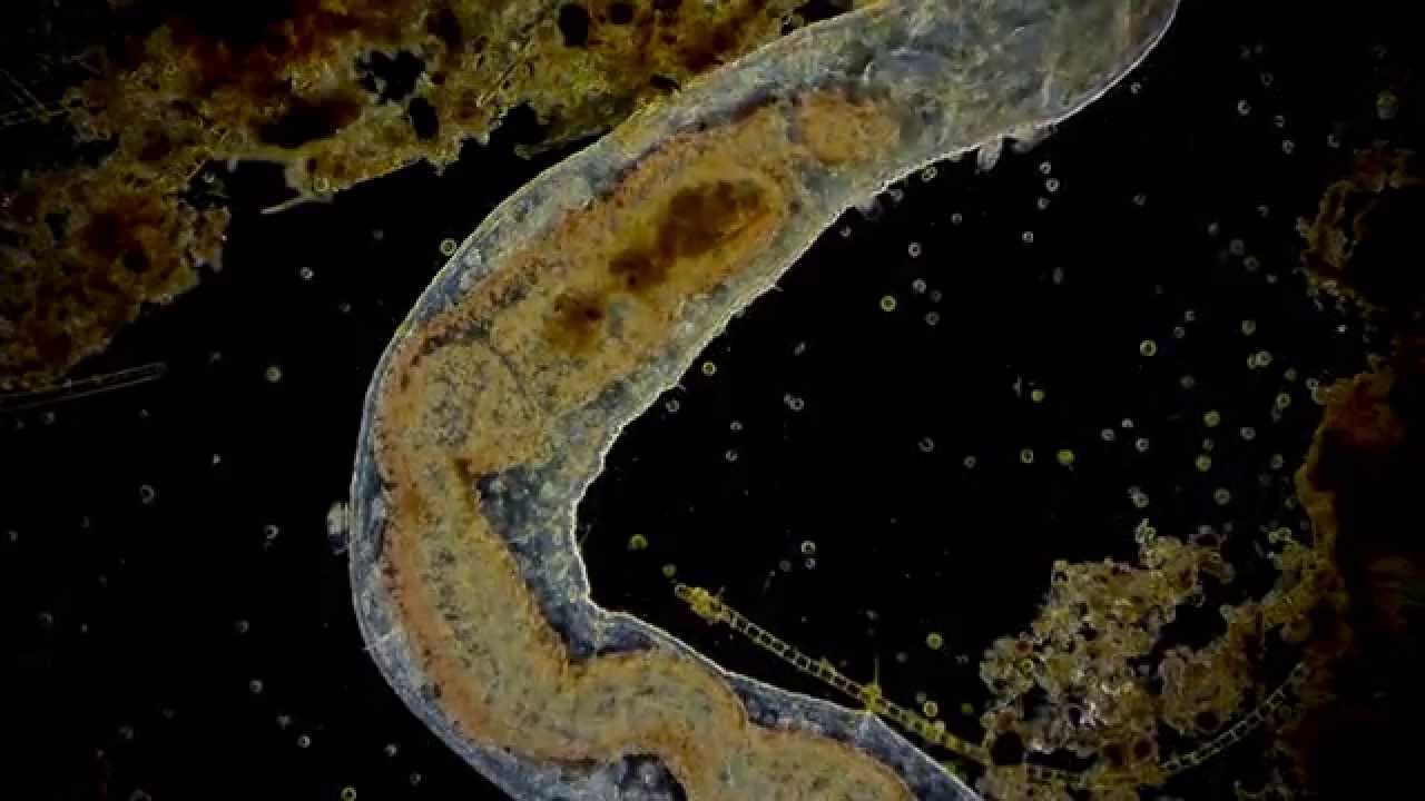 🔬 Annelid - Verdauung - Annelida under microscope - Ringelwurm - Leben ...